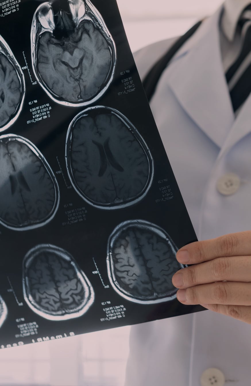 Trigeminal Neuralgia Dallas, TX | Tic Douloureux Addison, TX